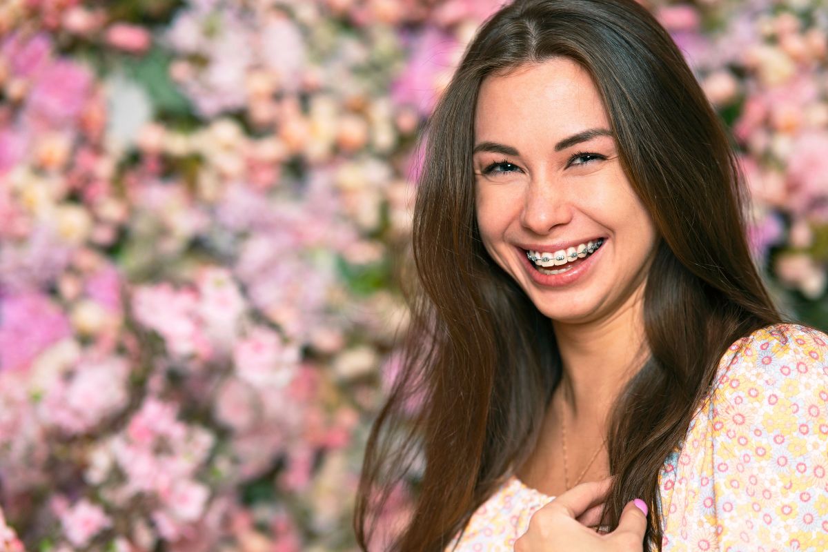 Spring Braces Colors, Osage Dental Group, MO